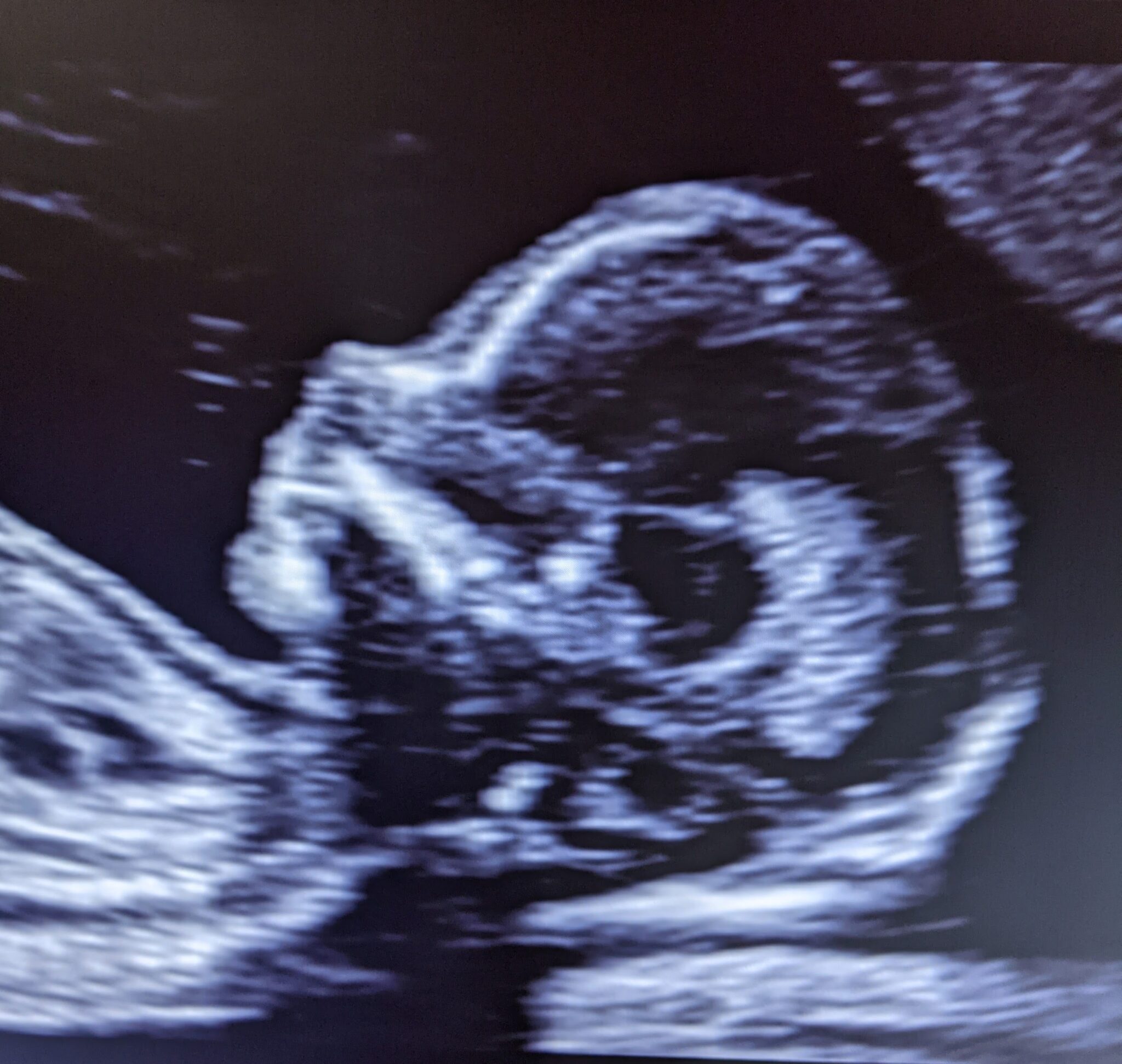 Services – Lescale Maternal Fetal Medicine